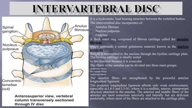 Lumber disc bulge/ Herniation/ Prolapse | PPTX