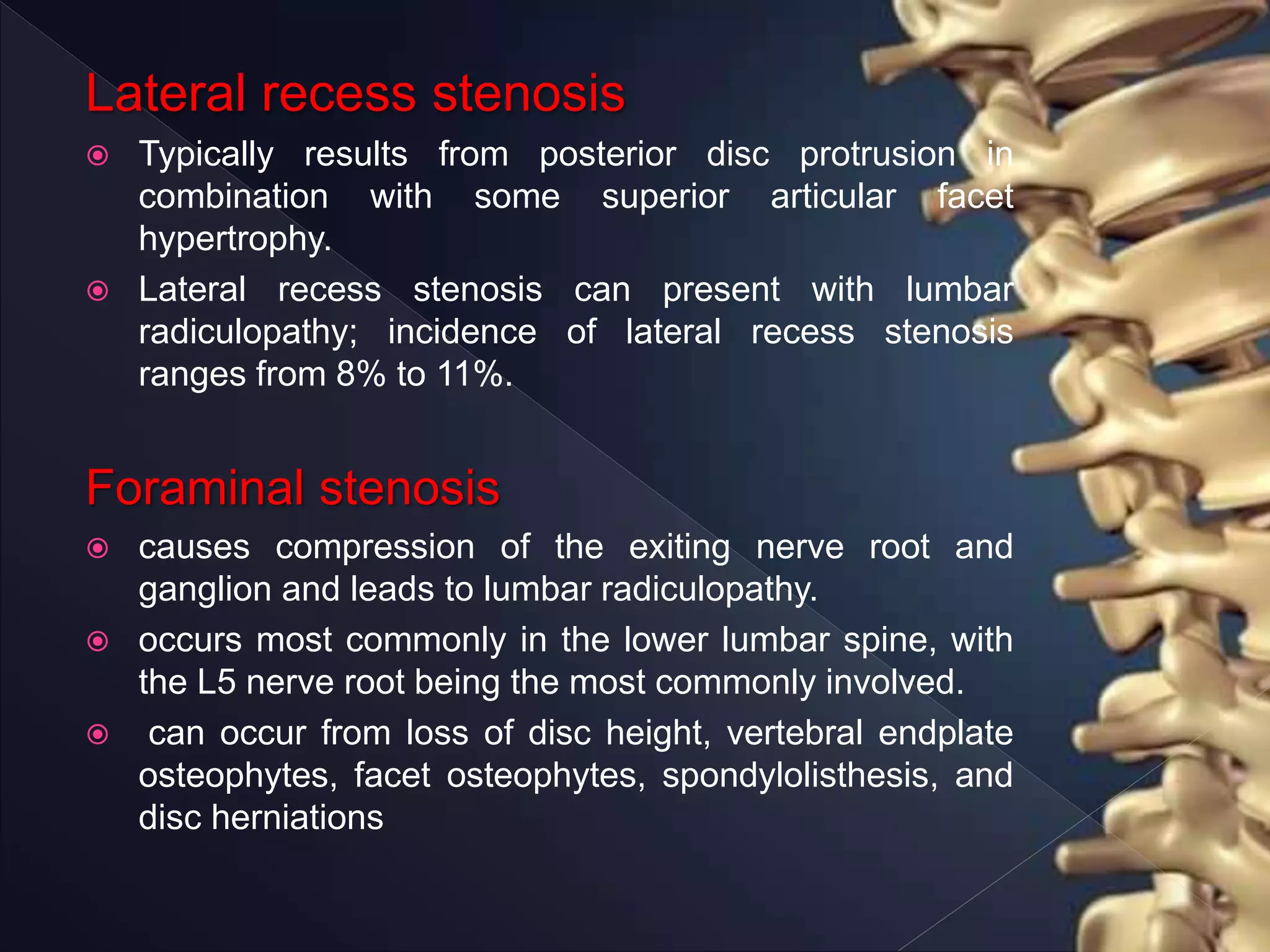 Lumbar spinal stenosis | PPTX