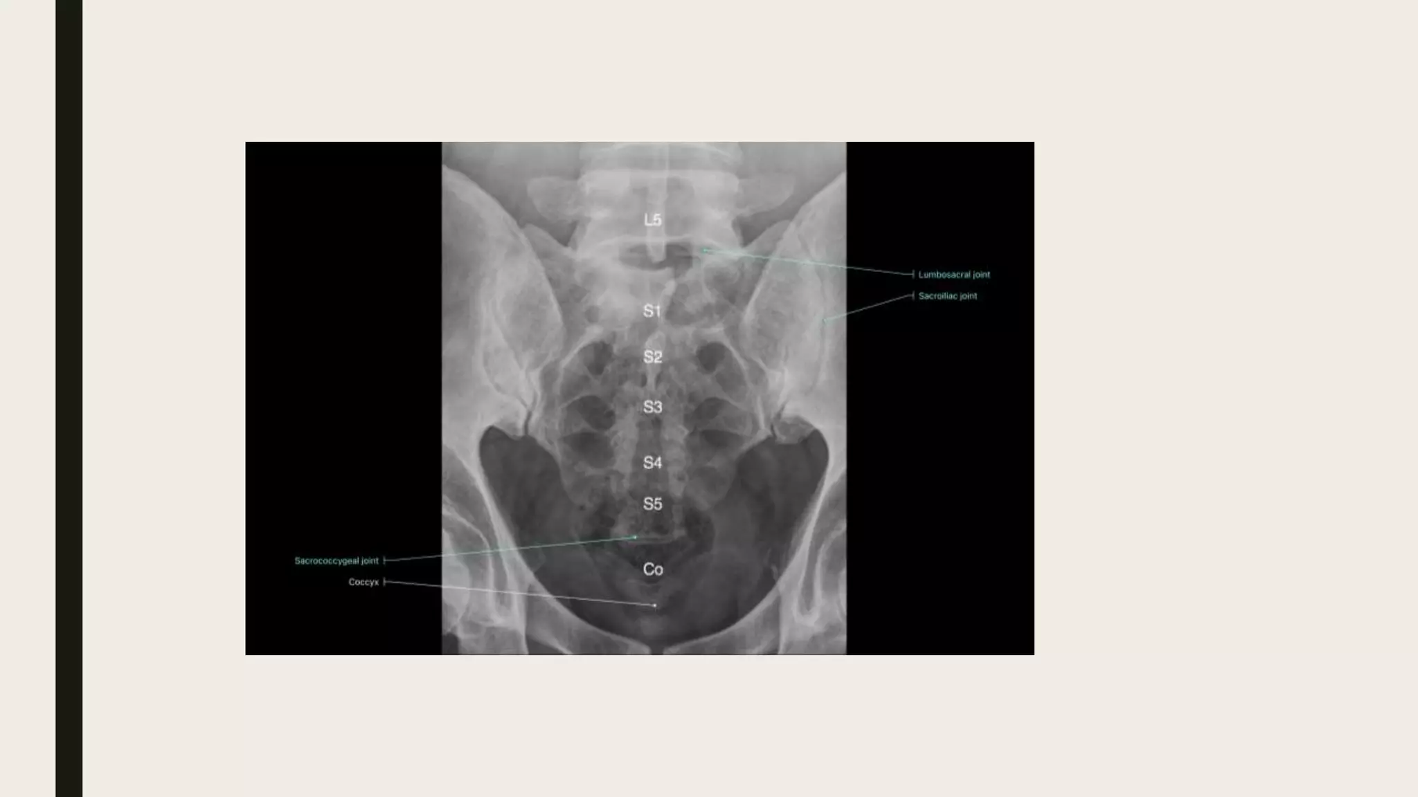 Lumbo sacral,coccyx sacrum anatomy and positioning | PPTX