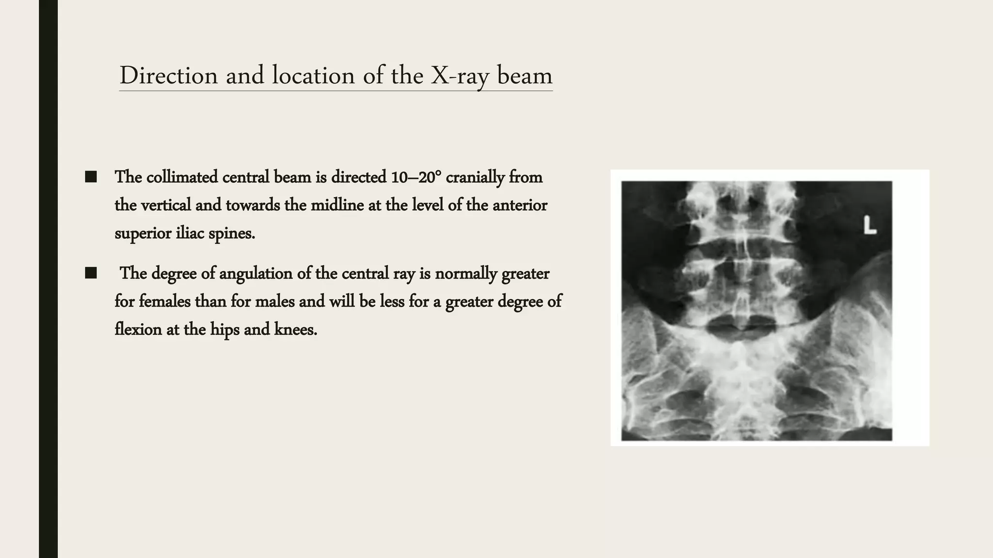 Lumbo sacral,coccyx sacrum anatomy and positioning | PPTX
