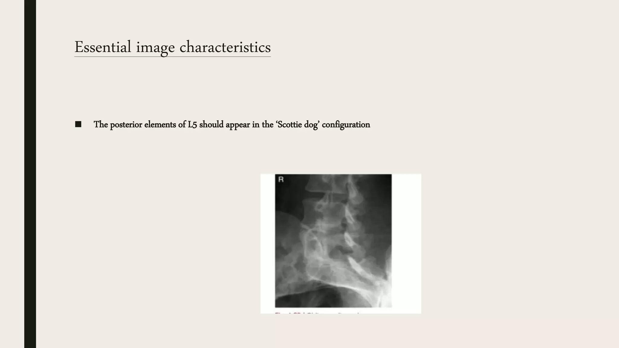 Lumbo sacral,coccyx sacrum anatomy and positioning | PPTX