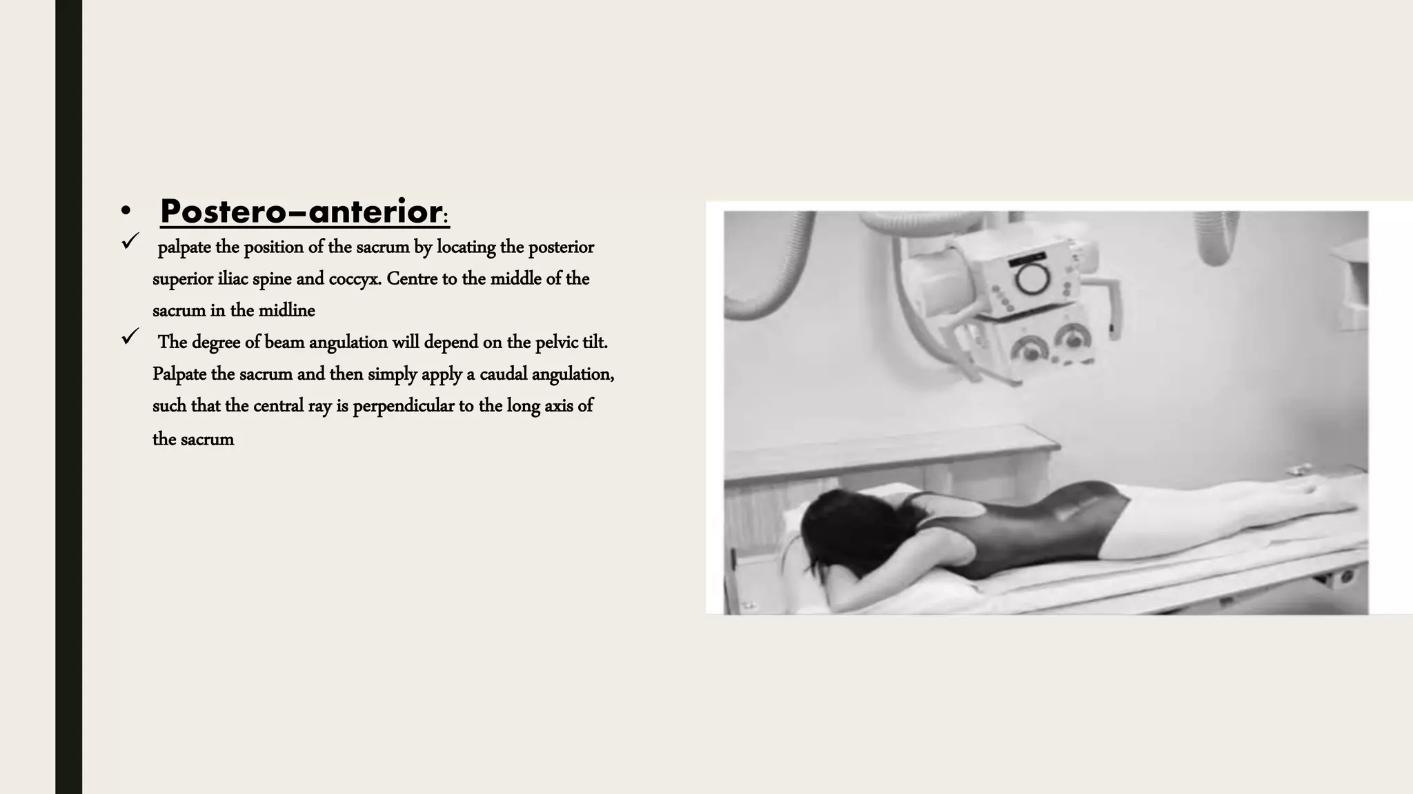 Lumbo sacral,coccyx sacrum anatomy and positioning | PPTX