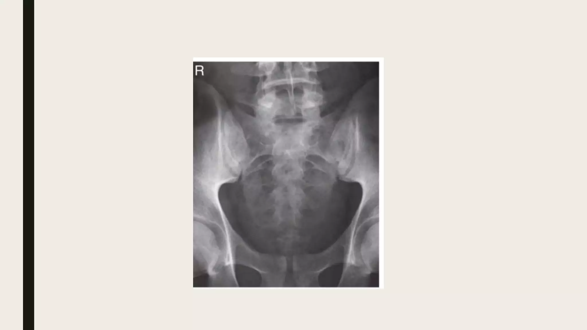 Lumbo sacral,coccyx sacrum anatomy and positioning | PPTX