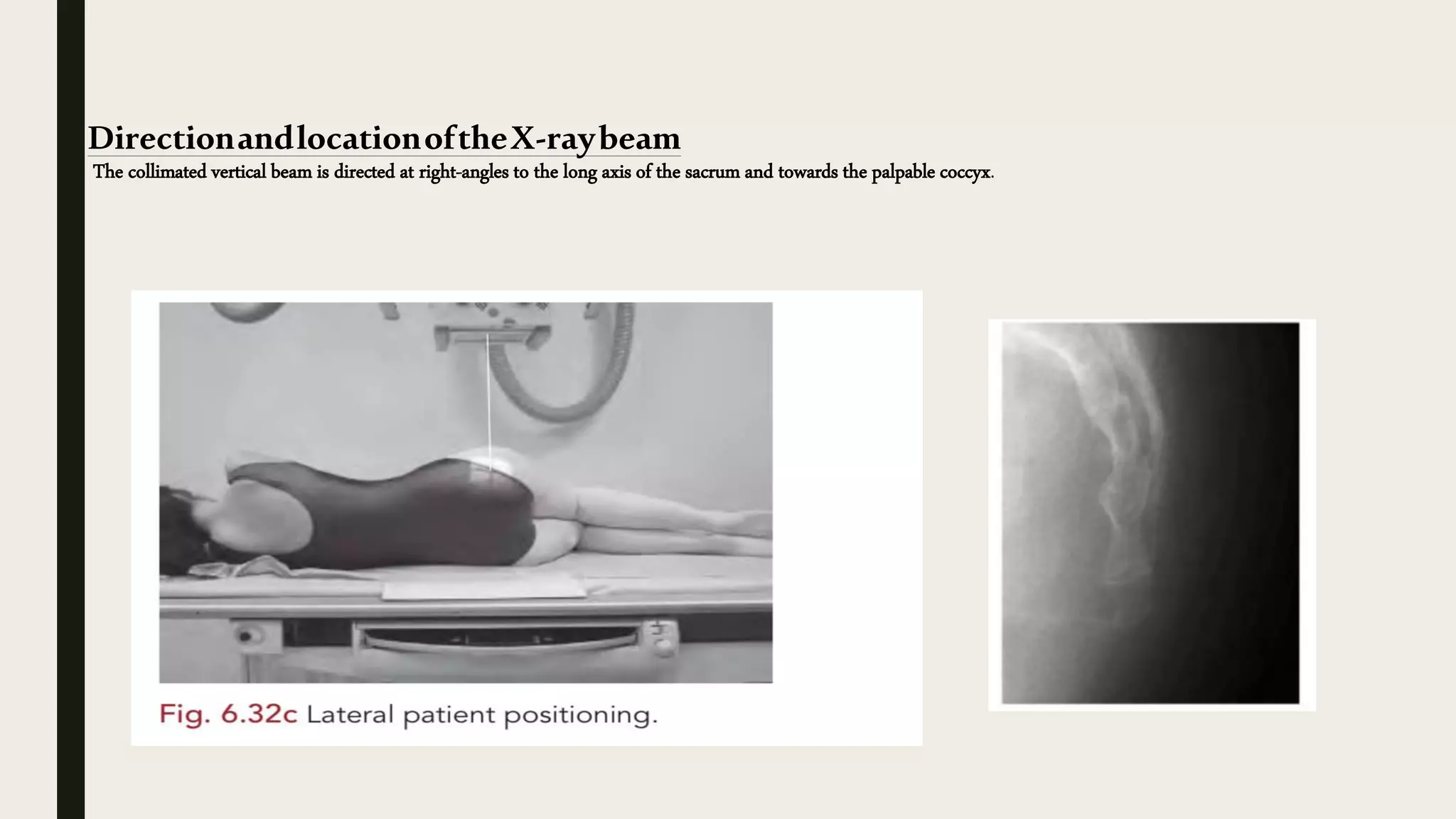 Lumbo sacral,coccyx sacrum anatomy and positioning | PPTX