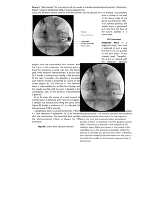 Lumbosacral radicular pain 1 | PDF