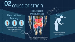 Physiotherapist POV : LumboSacral Strain | PPTX