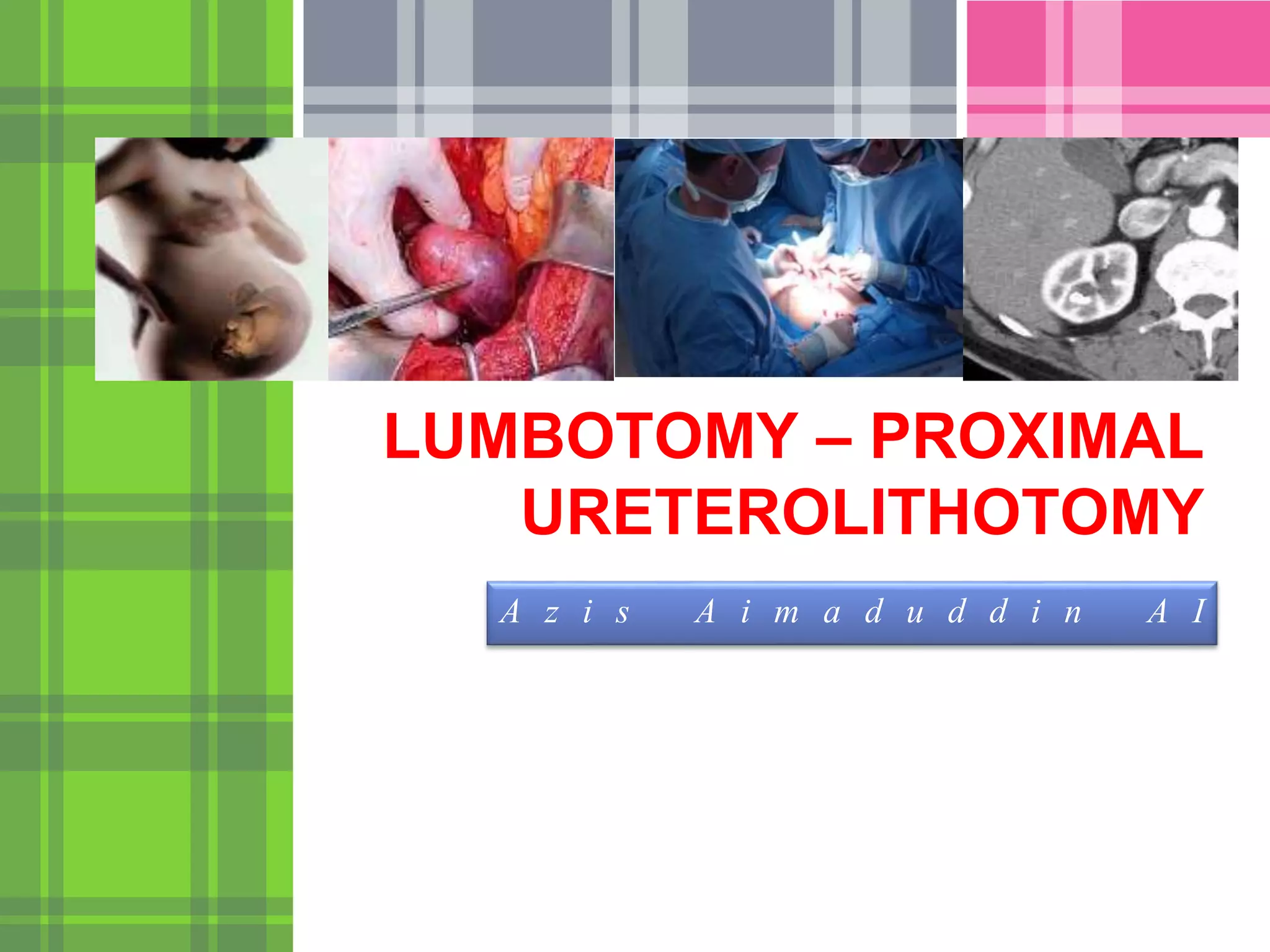 OPTEK Lumbotomy proximal ureterolithotomy | PPTX