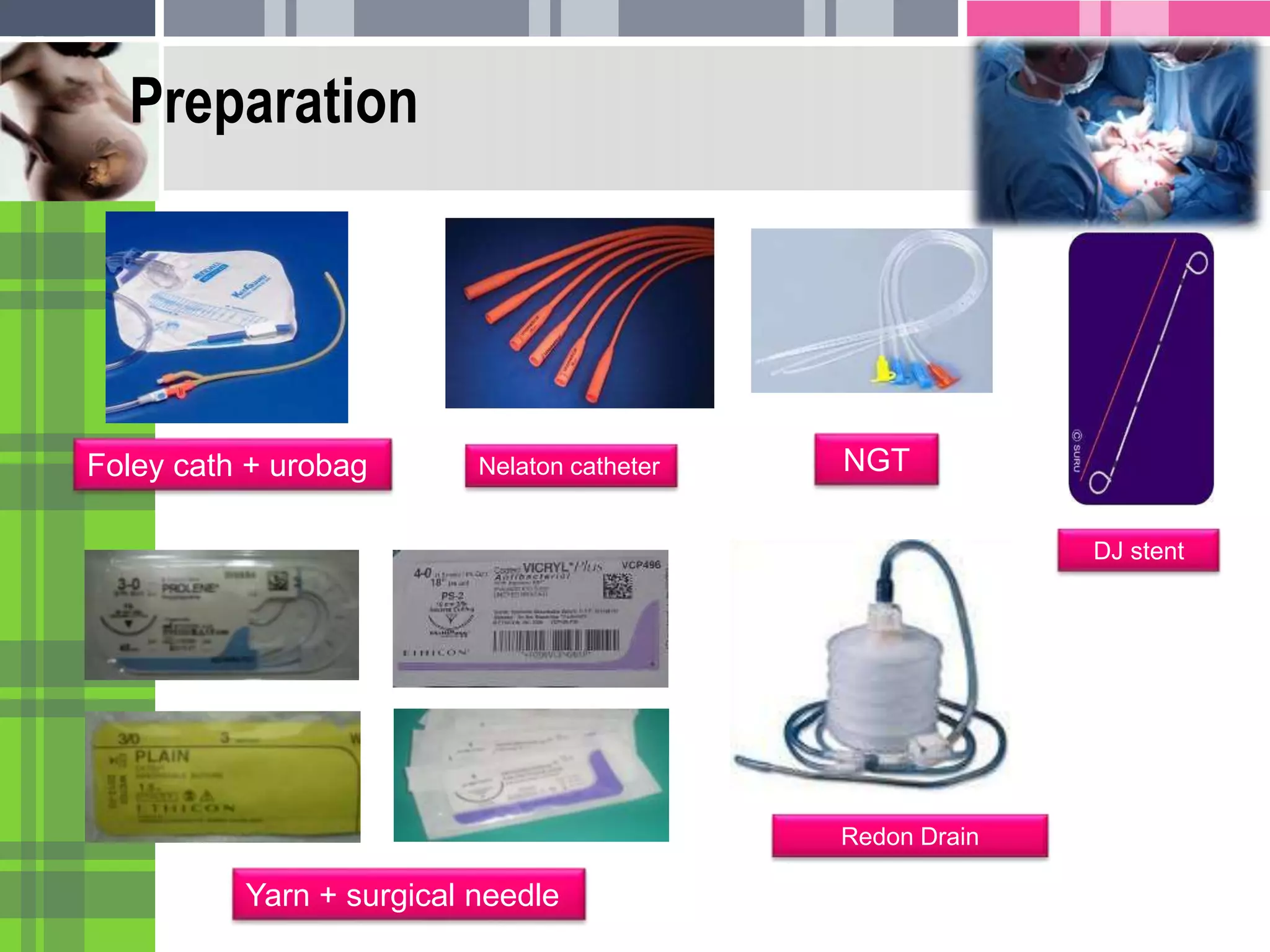 OPTEK Lumbotomy proximal ureterolithotomy | PPTX