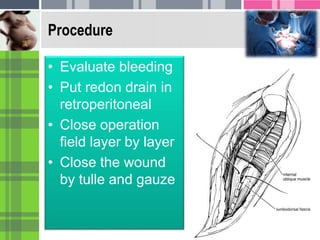 OPTEK Lumbotomy proximal ureterolithotomy | PPTX | Death, Injury, or ...