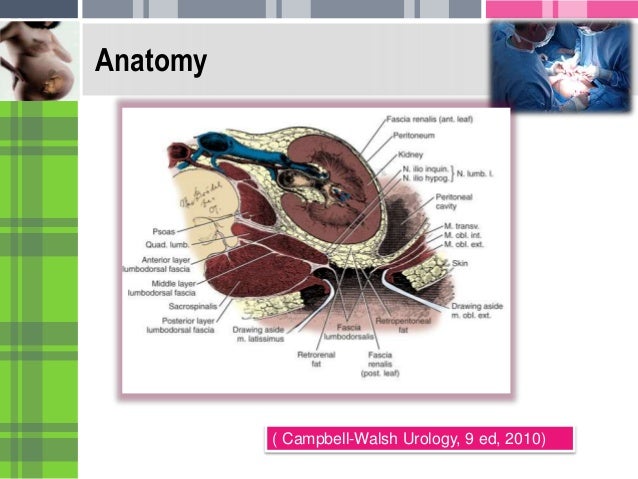 OPTEK Lumbotomy proximal ureterolithotomy