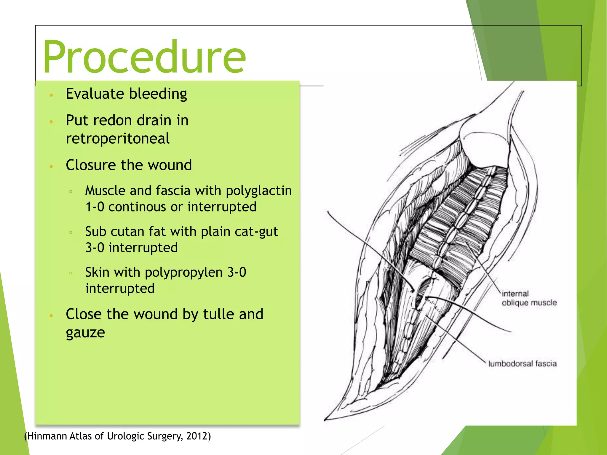 Lumbotomy- Proximal Ureterolithotomy.pptx