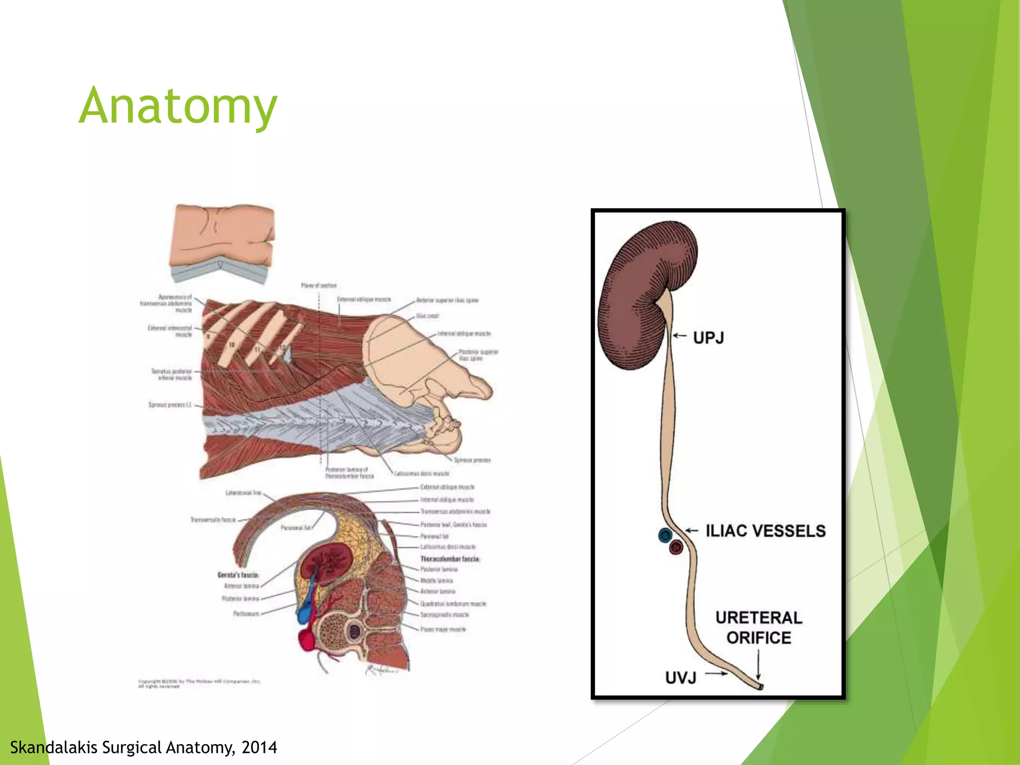 Lumbotomy- Proximal Ureterolithotomy.pptx