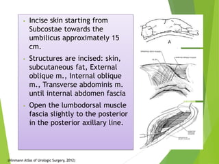 Lumbotomy- Proximal Ureterolithotomy.pptx