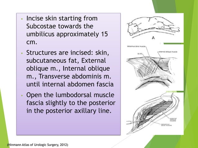Lumbotomy- Proximal Ureterolithotomy.pptx | Death, Injury, or Military ...