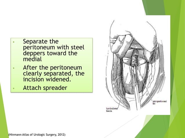 Lumbotomy- Proximal Ureterolithotomy.pptx | Death, Injury, or Military ...