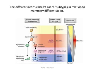 MANAGEMENT OF LUMINAL BREAST CANCER.pptx