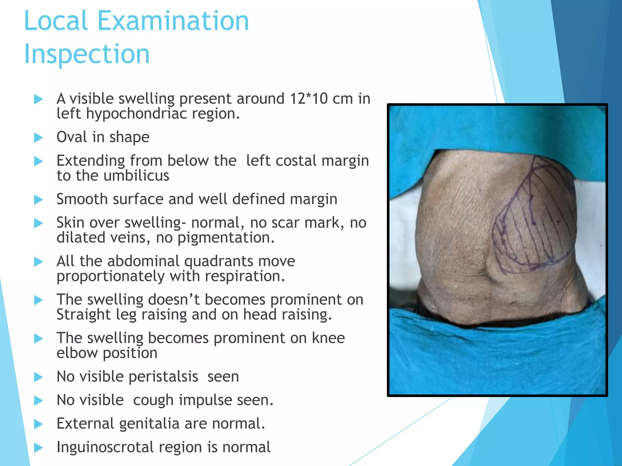 lump in abdomen (2).pptx