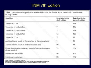 The IASLC Lung Cancer Staging Project: Proposals for the TNM Stage ...
