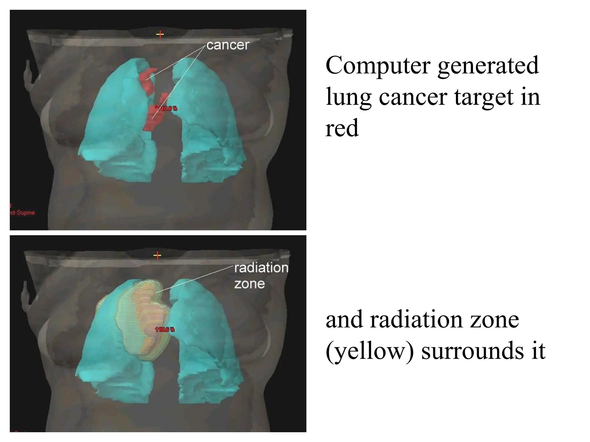 lung-090803151811-phpapp01.ppt lung carcinoma | PPT