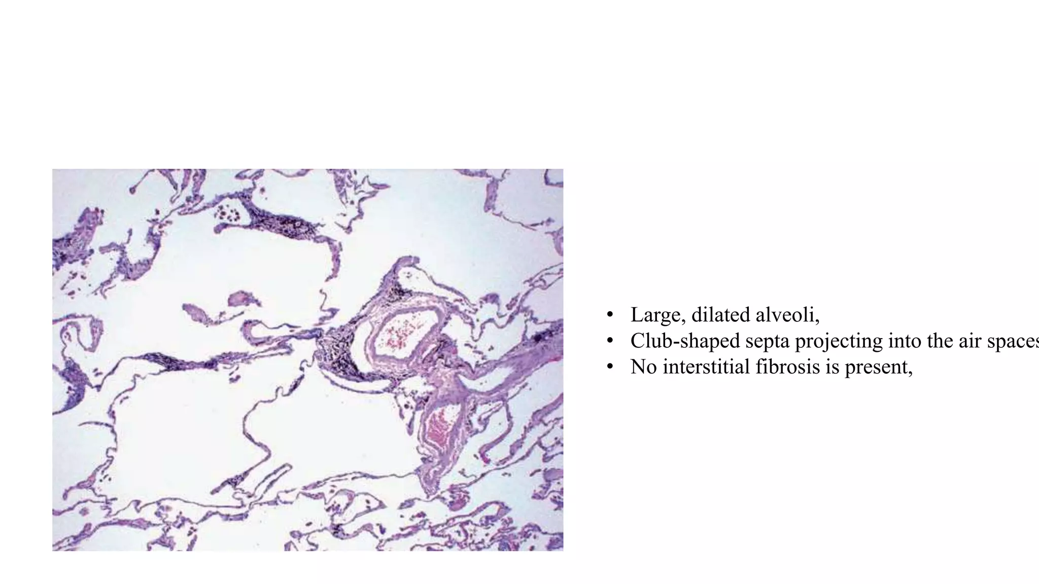 lung- Gross &Microscopy | PPTX