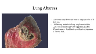 lung- Gross &Microscopy | PPTX