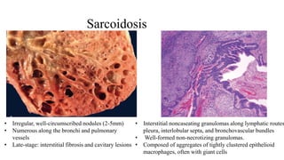 lung- Gross &Microscopy | PPTX