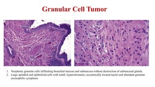 lung- Gross &Microscopy | PPTX