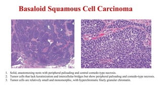 lung- Gross &Microscopy | PPTX
