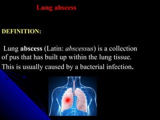 lung-abscess. Dr ibrahimi md pulmonologist.ppt
