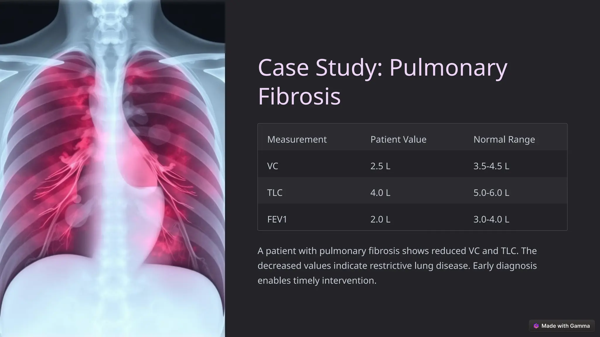 Lung-Volumes-and-Capacities-An-Overview.pptx