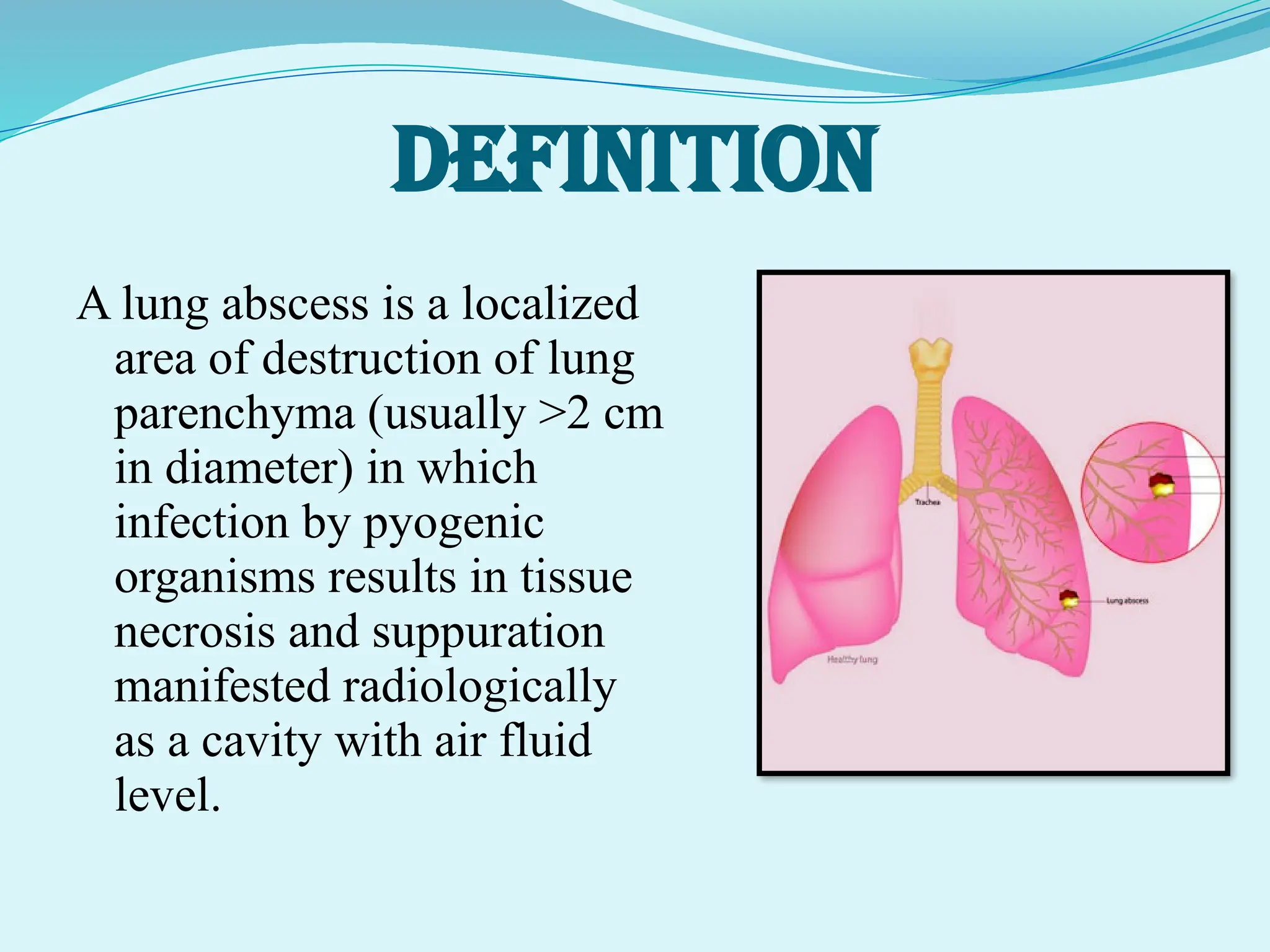 lung abscess-1.pptx a pus filled cavity to lungs | PPTX