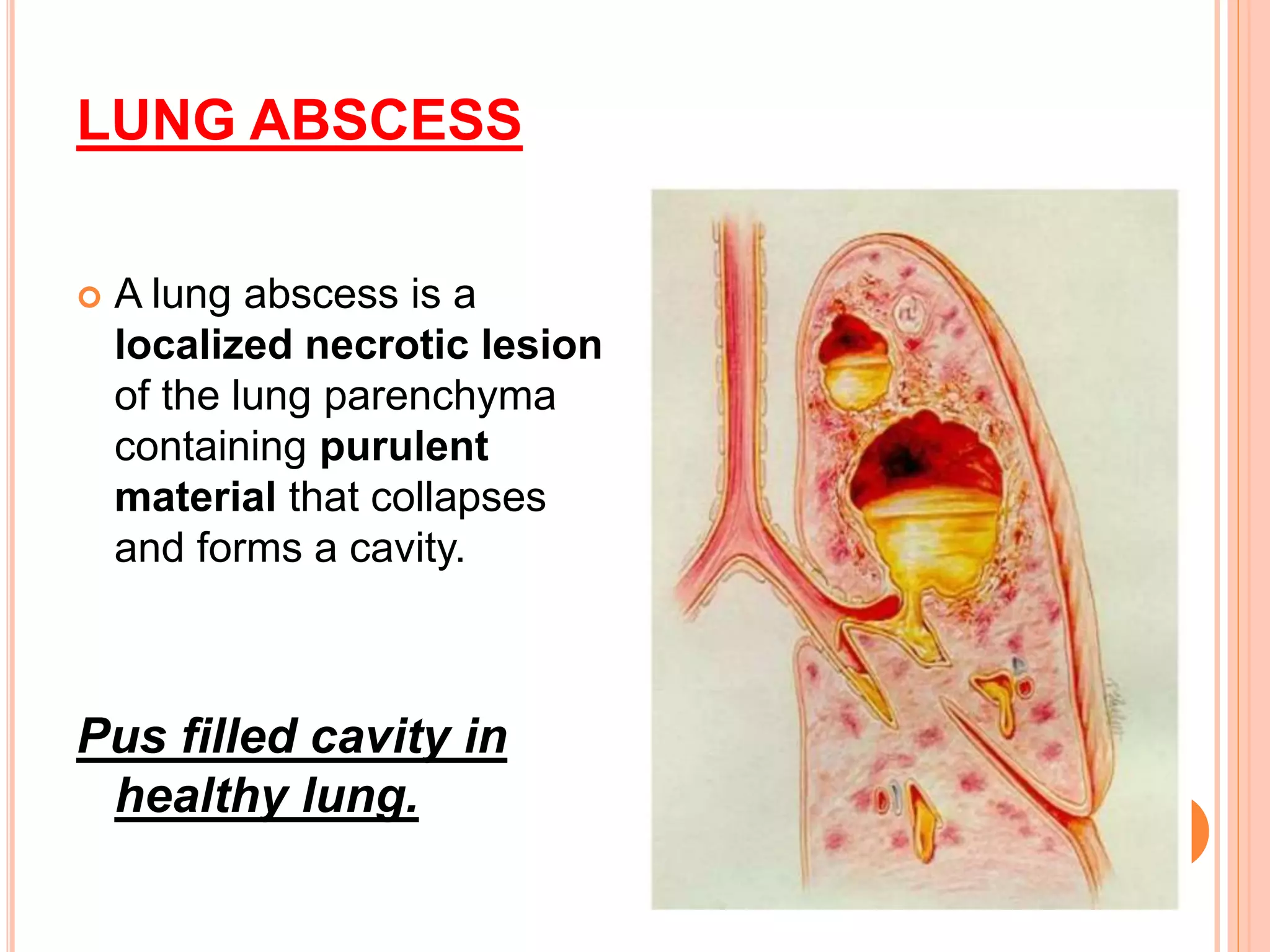 Lung Abscess And Nursing Care Ppt