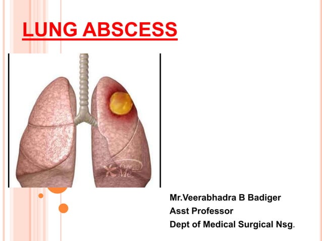 Lung abscess & Nursing care | PPTX