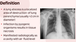 LUNG ABSCESS.pptx