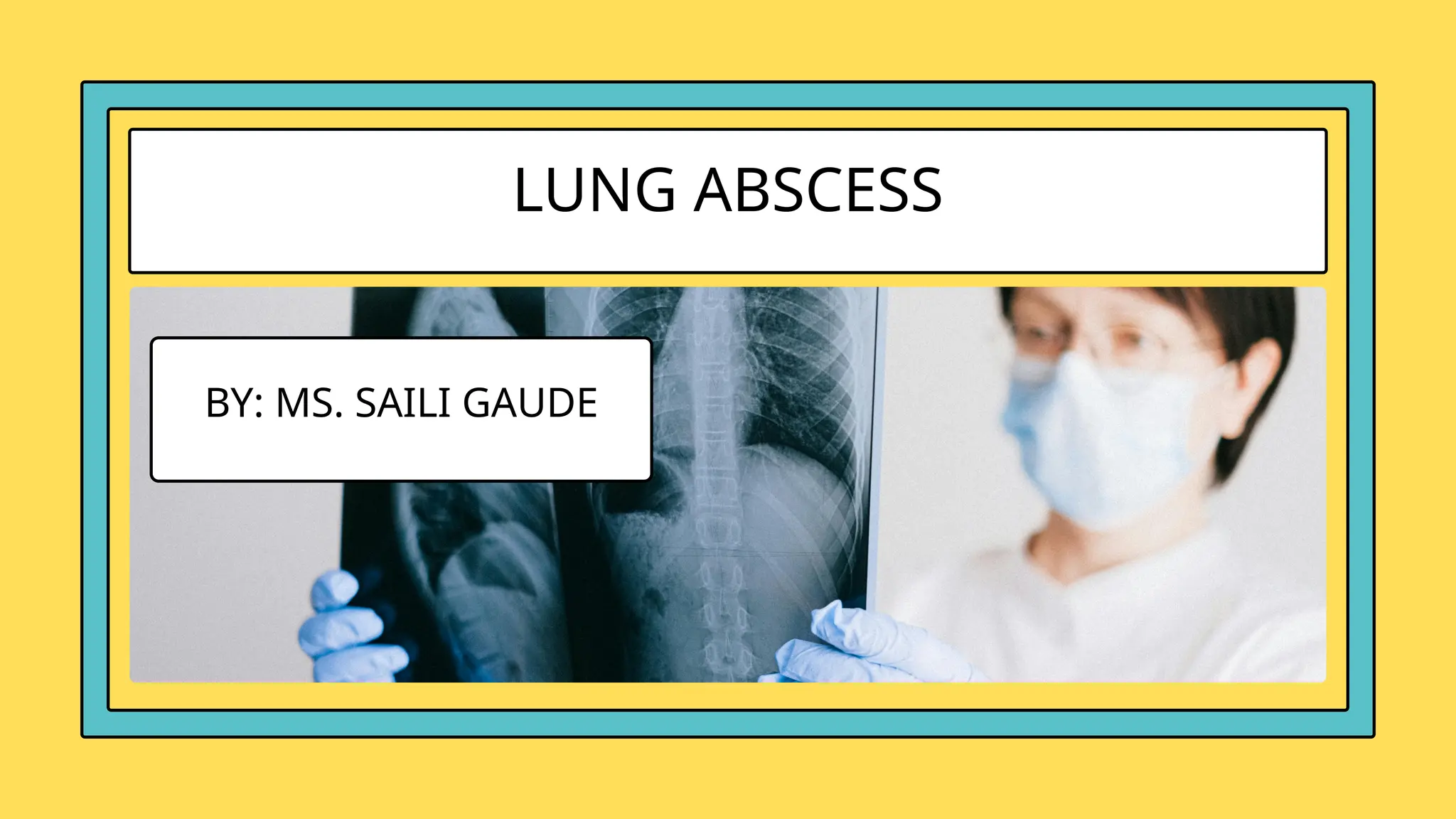 LUNG ABSCESS- Causes , pathophysiology and treatment | PPTX