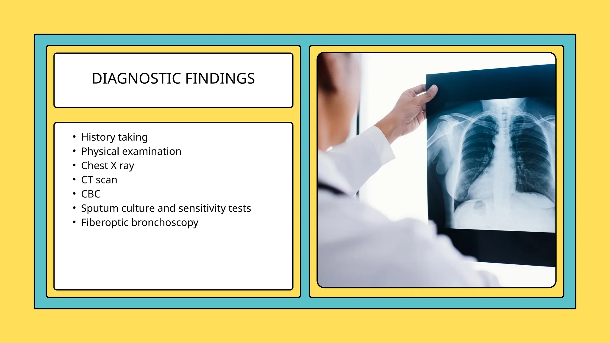 LUNG ABSCESS- Causes , pathophysiology and treatment | PPTX