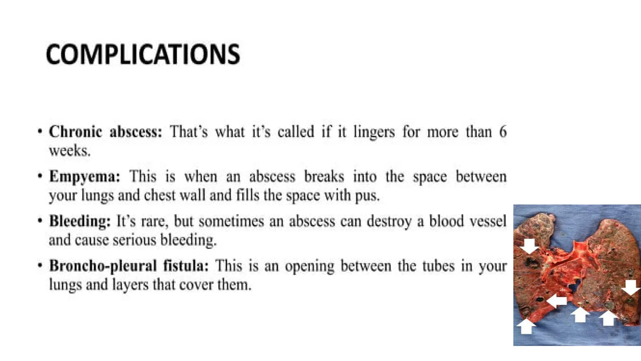 LUNG ABSCESS.pptx........................ | PPTX
