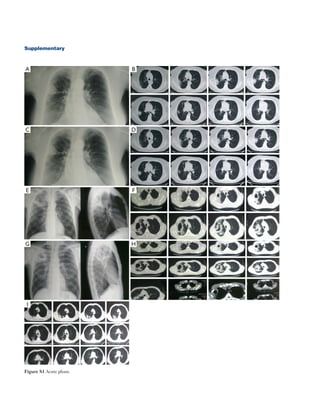 Lung abscess-etiology, diagnostic and treatment options-2015.pdf | Lung ...
