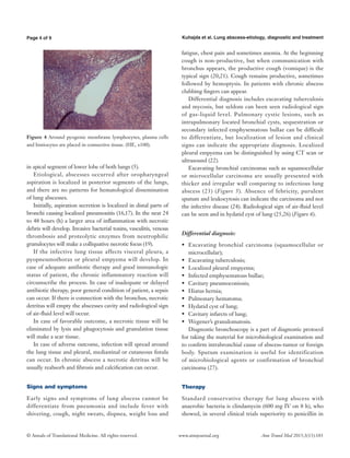 Lung abscess-etiology, diagnostic and treatment options-2015.pdf
