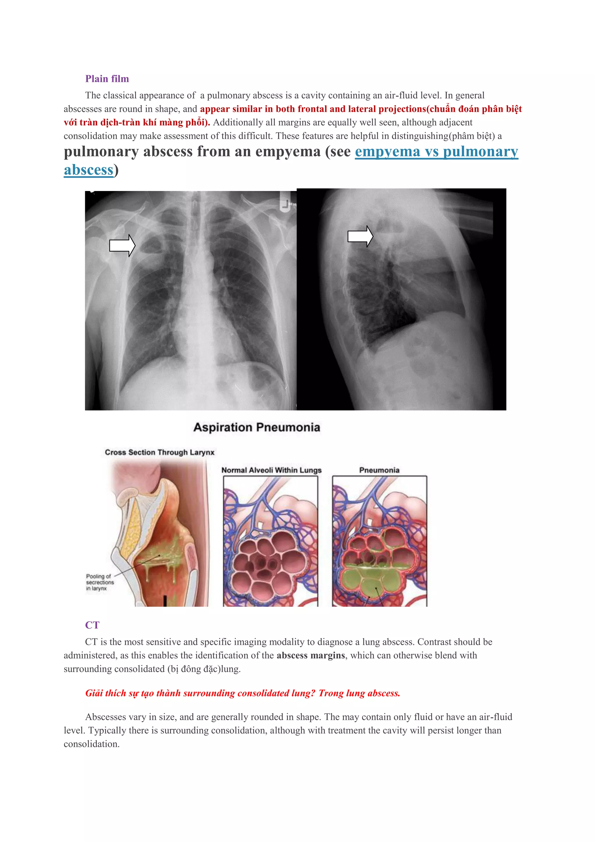 Lung abscess pdf | PDF