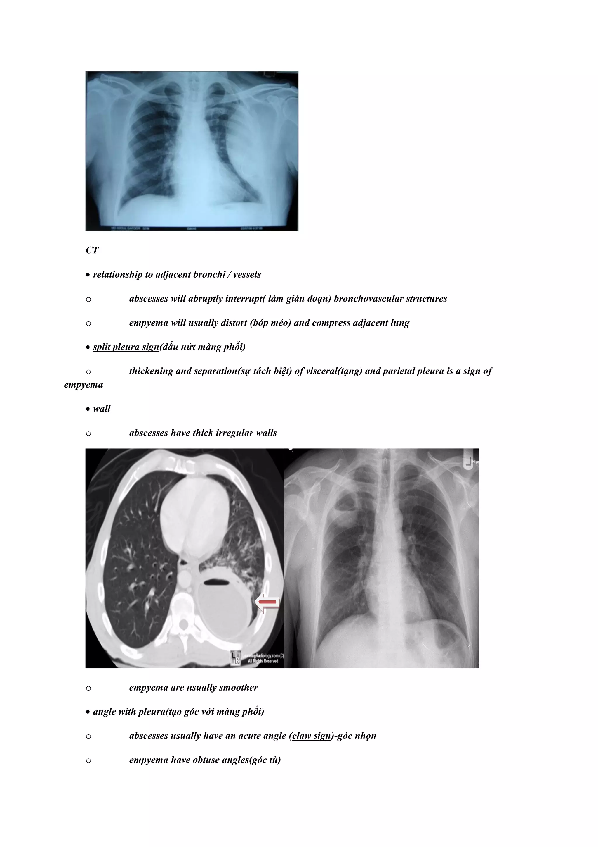 Lung abscess pdf | PDF