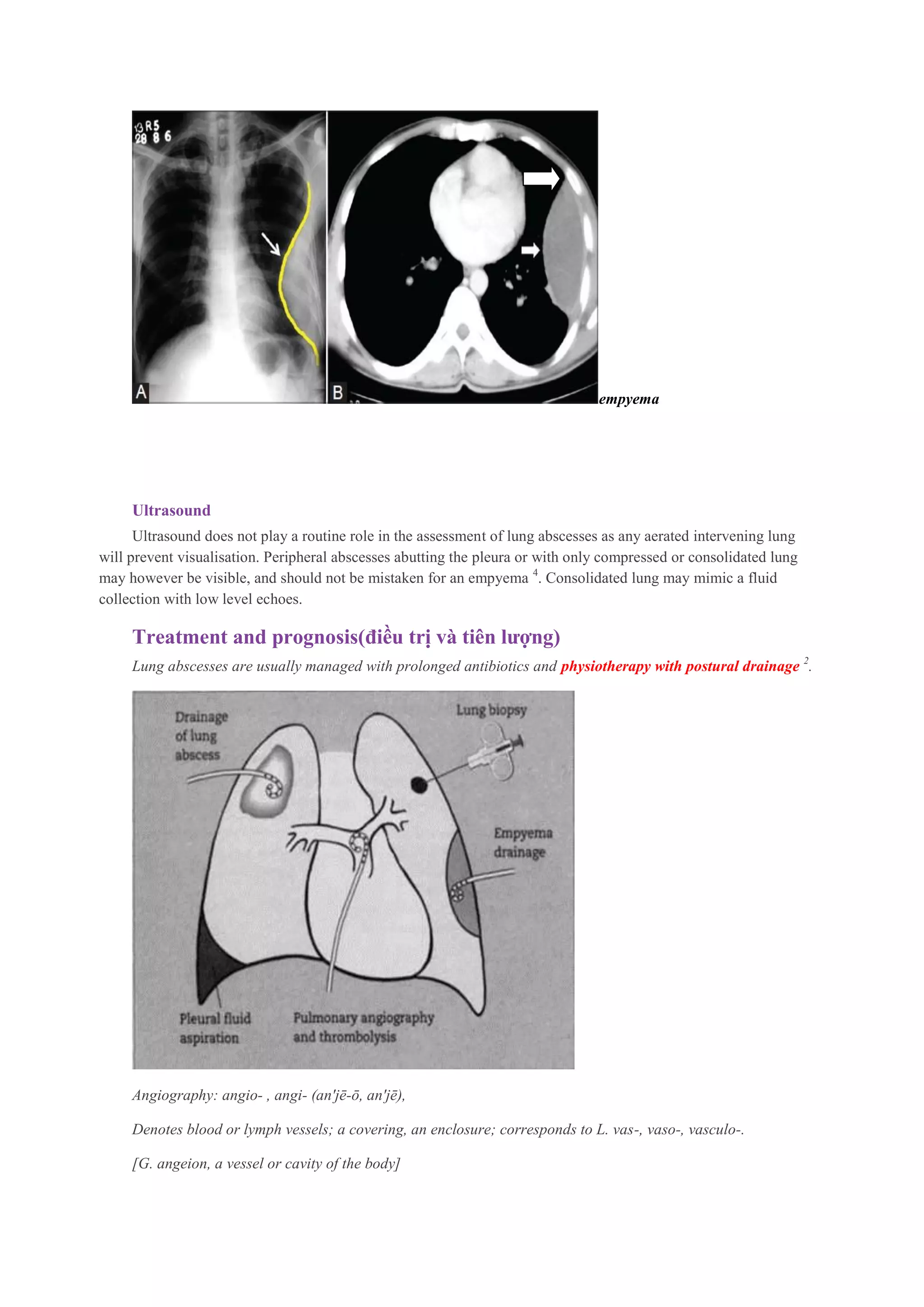 Lung abscess pdf | PDF