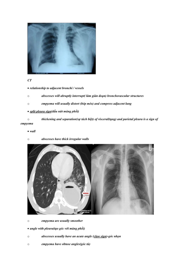 Lung abscess pdf | PDF