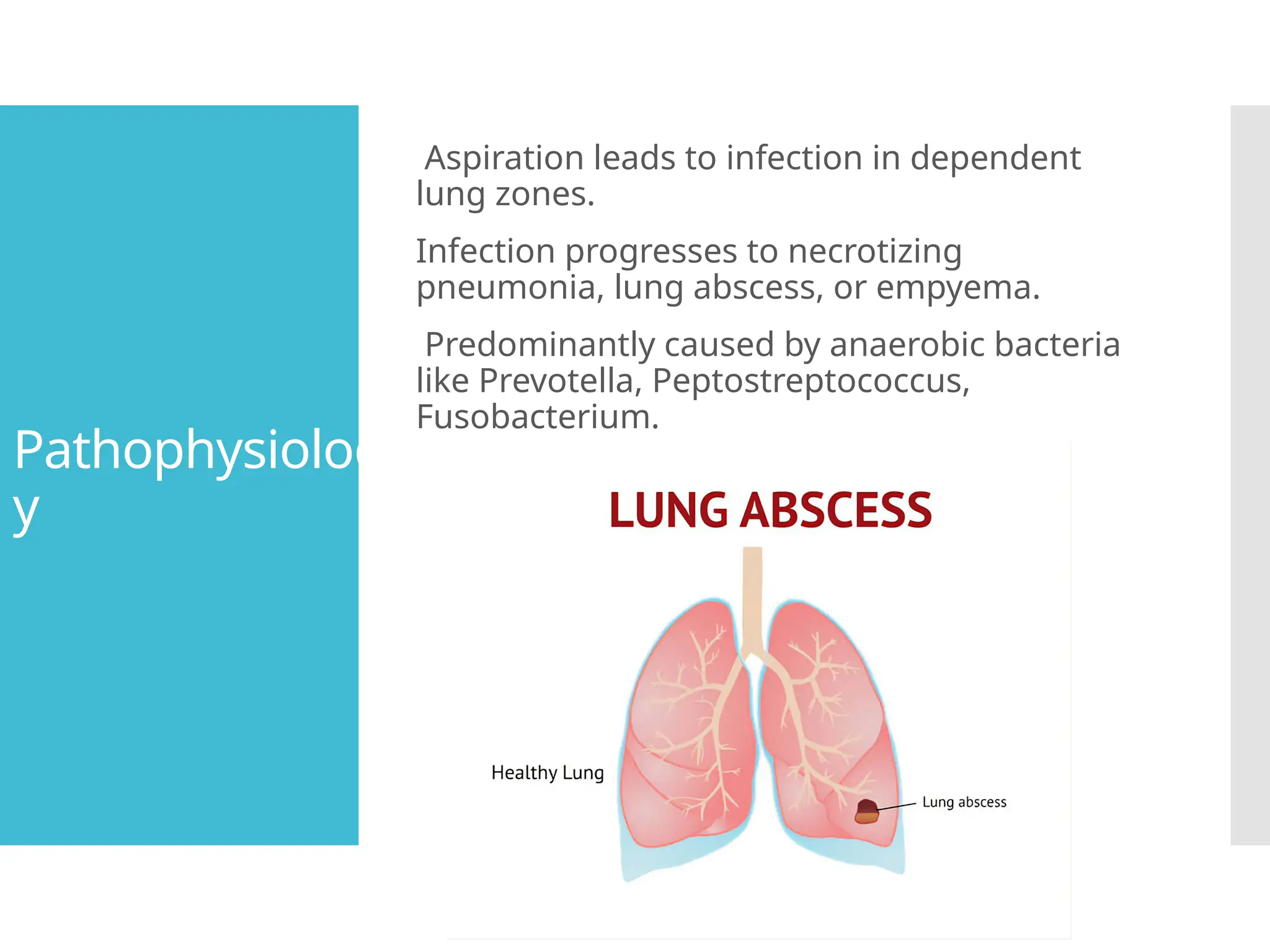 Lung_Abscess_Presentation full details.pptx