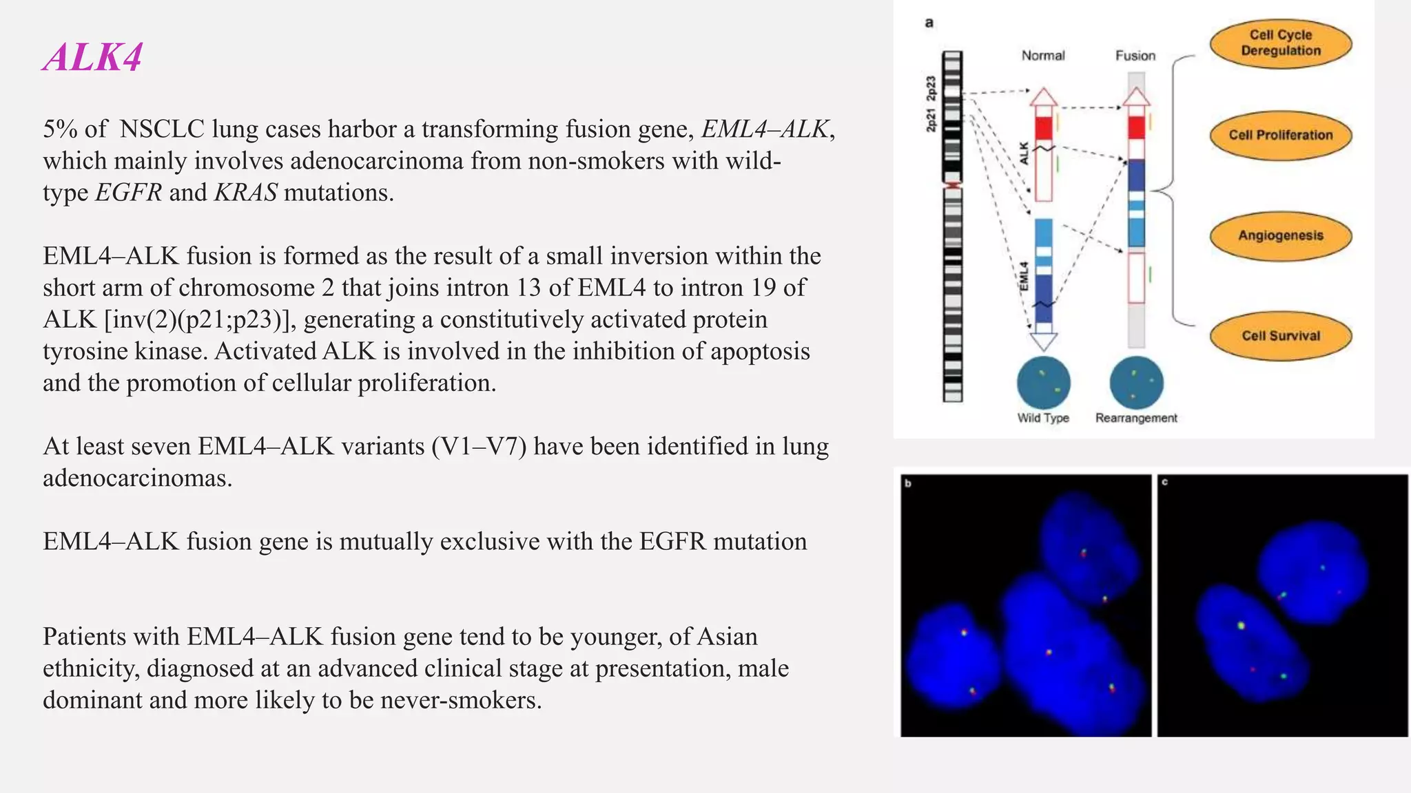 Lung adenocarcinoma -molecular pathology | PPTX