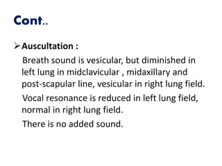 Lung agenesis | PPTX