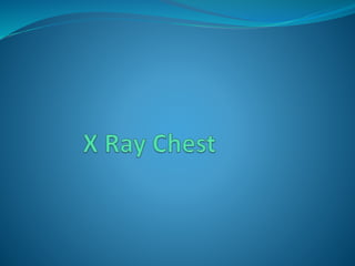 Lymph nodal stations in ca lung | PPTX