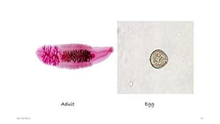 Lung and Liver Flukes - Parasitology Group 3 Presentation.pdf