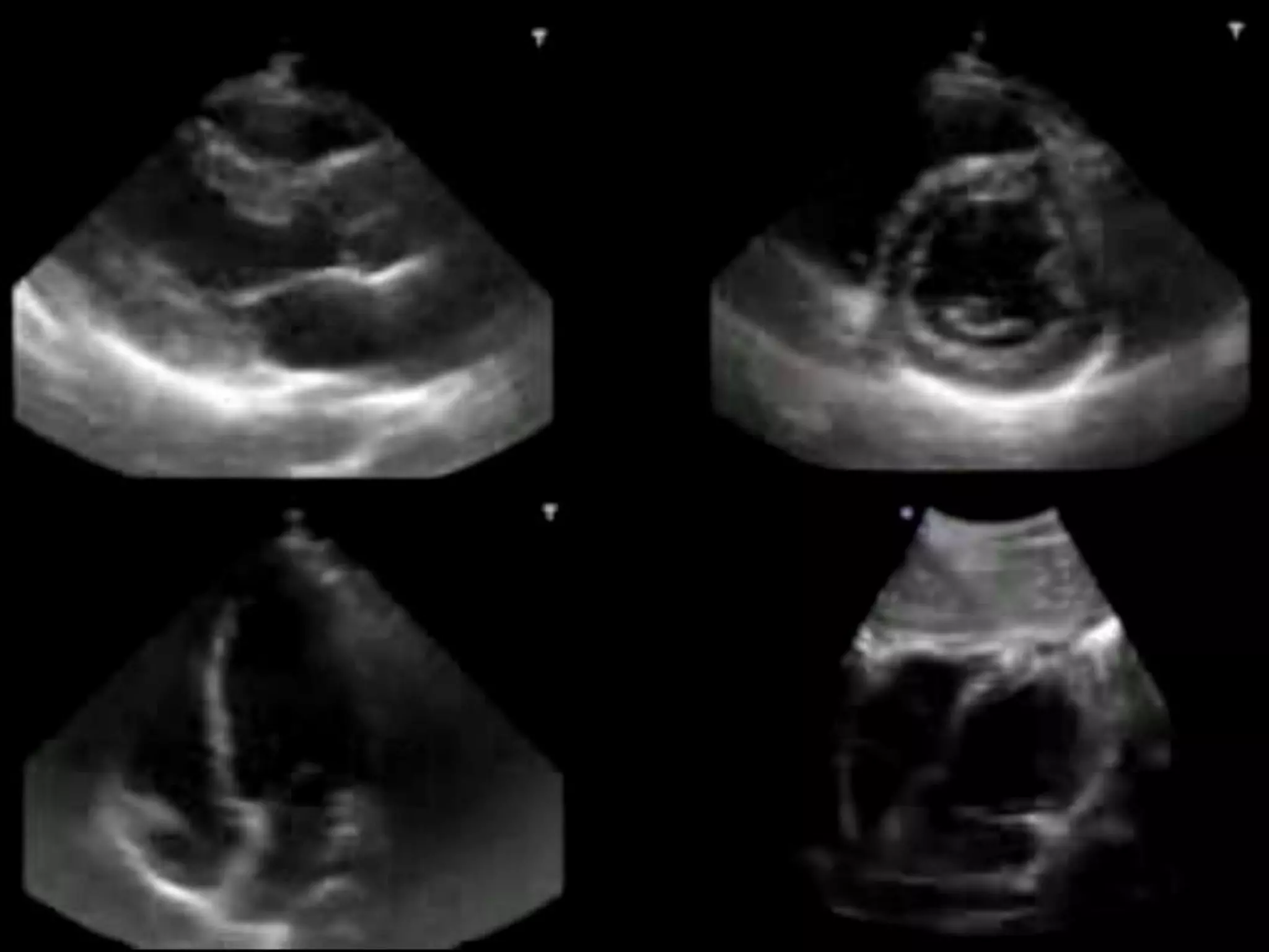 Lung and Pleural Ultrasonography - Ultrasound Guided Vascular Access ...
