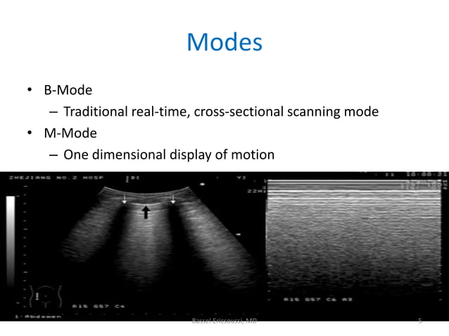 Lung and Pleural Ultrasonography - Ultrasound Guided Vascular Access ...